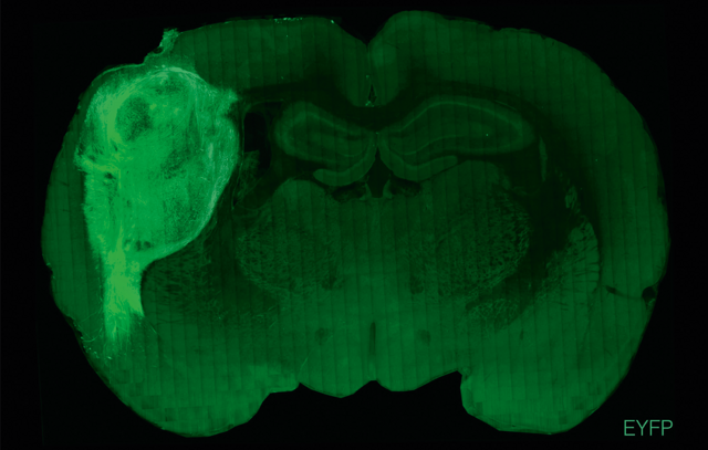 Neuroni umani nel cervello dei ratti - Alexandru Micu - Internazionale